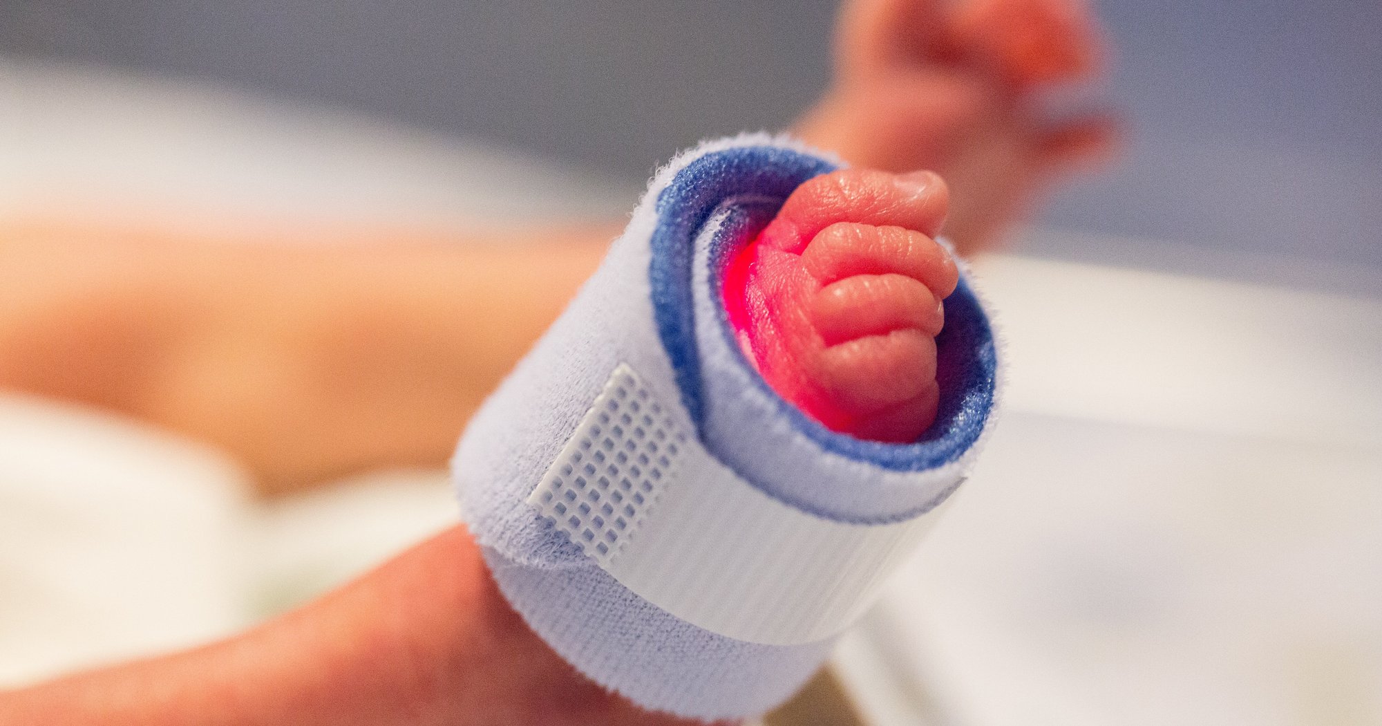 Neonatal complications: What parents should know - www.neopedia.org