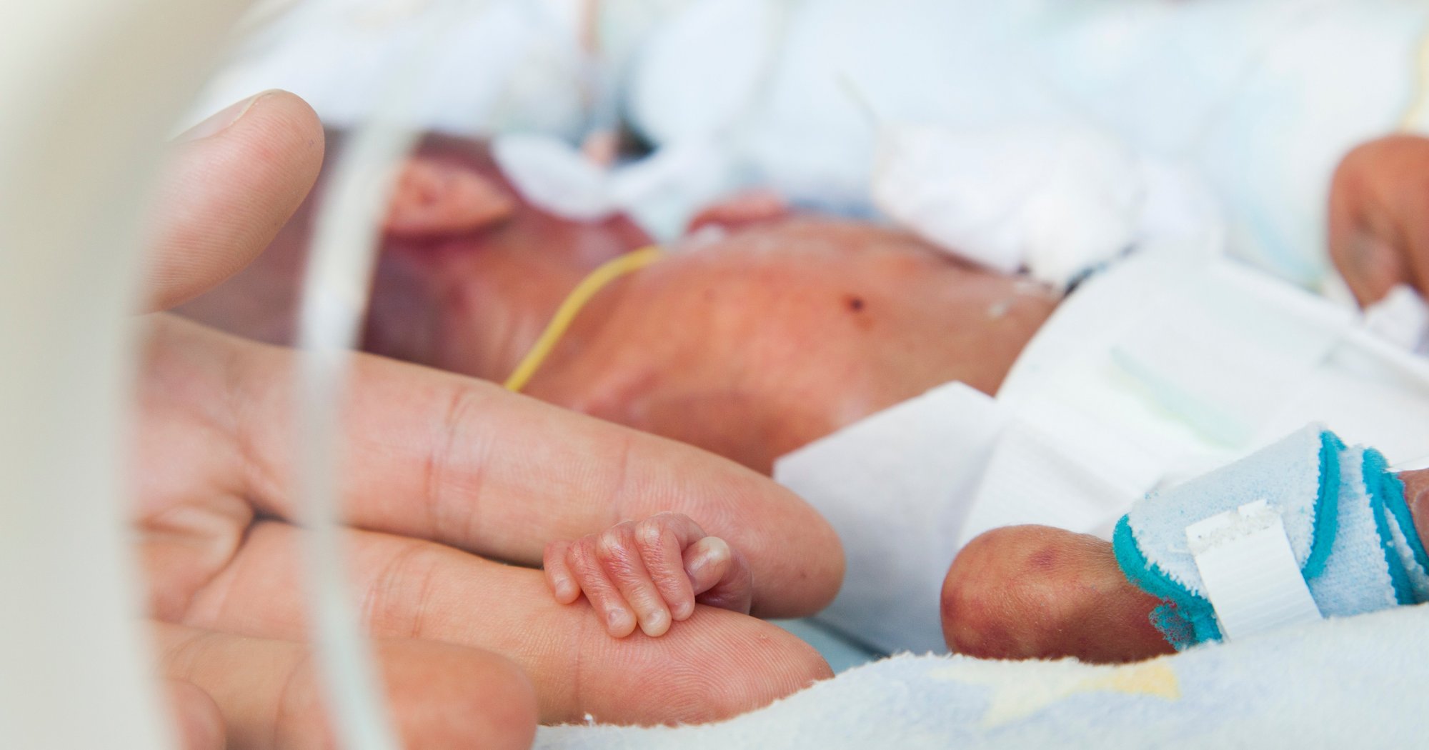 The NICU experience: A guide for parents - www.neopedia.org